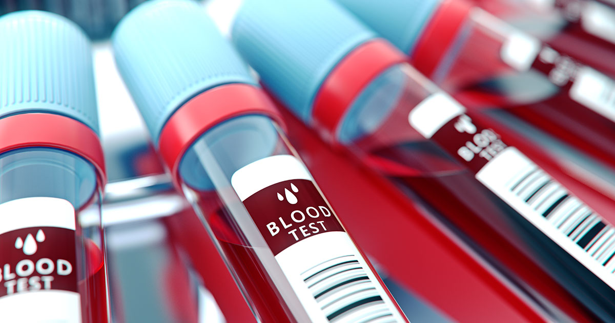 WisBar News: U.S. Supreme Decides Wisconsin Unconscious Driver, OWI ...